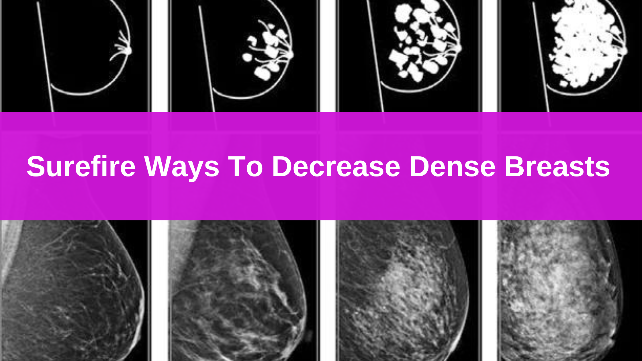 The Most Surefire Ways To Decrease Dense Breasts - Breast Cancer Conqueror The Most Surefire Ways To Decrease Dense Breasts - Breast Cancer Conqueror
