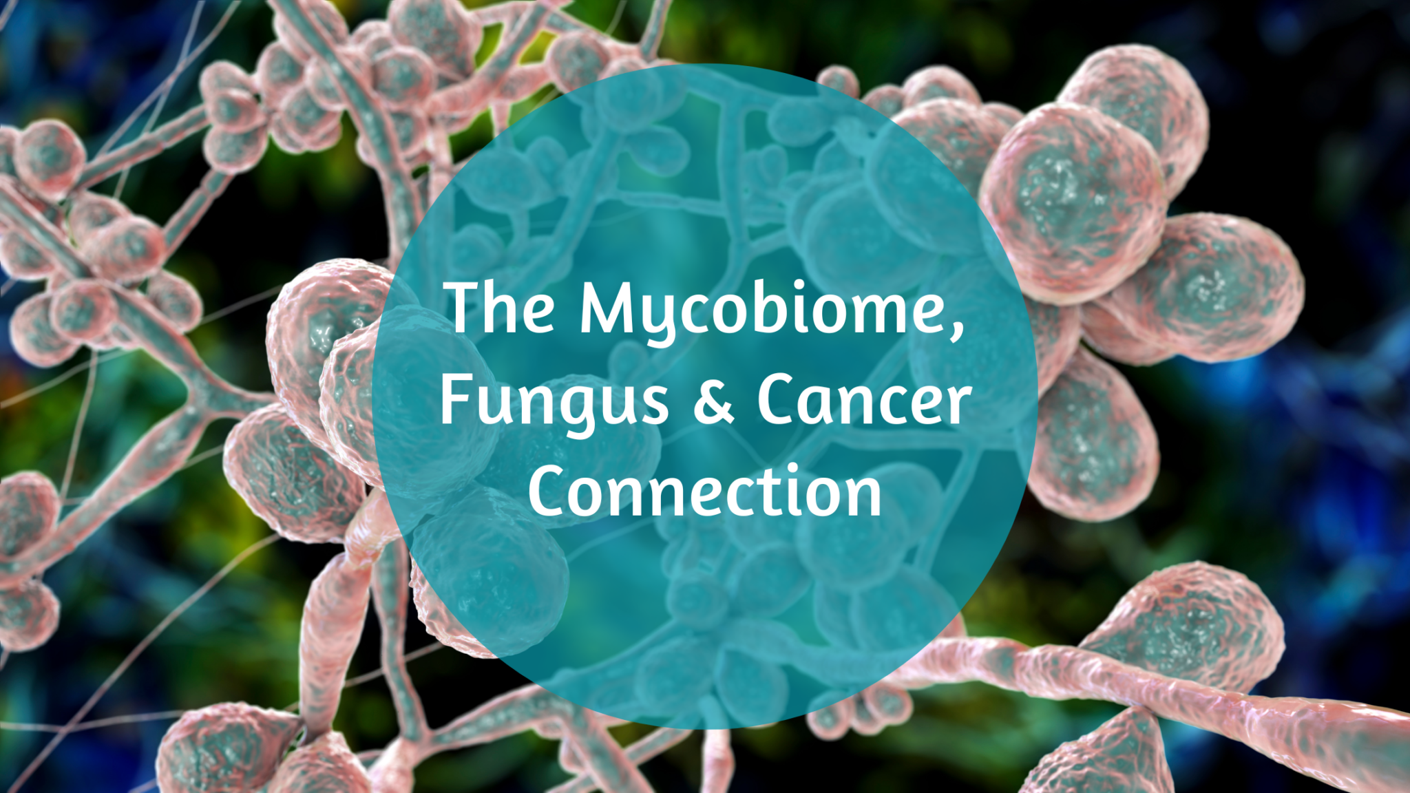 The Mycobiome, Fungus & Cancer Connection